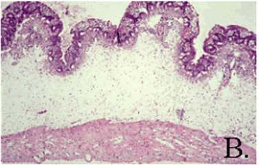 Antibiotic-Induced Enterotoxemia / Hemorrhagic Typhlitis – College of ...