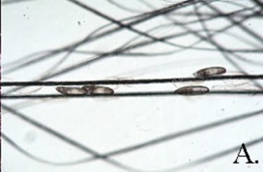 Fur Mites of Mice – College of Veterinary Medicine