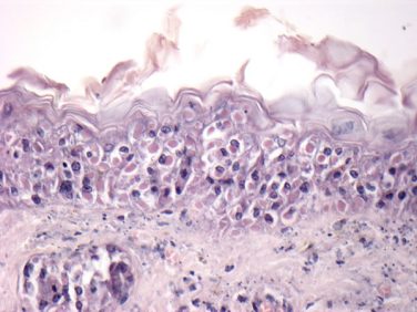 Ectromelia Virus (Mousepox) – College of Veterinary Medicine