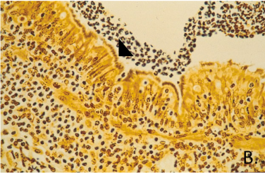 Filobacterium rodentium (formerly CAR Bacillus) – College of Veterinary ...