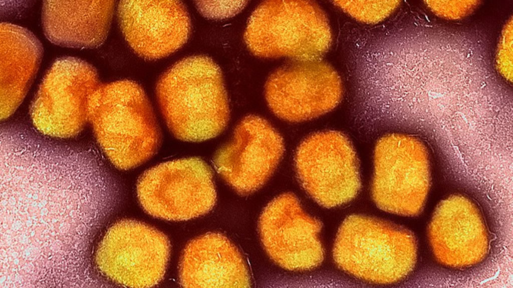 Monkeypox Mutations Cause Virus to Spread Rapidly, Evade Drugs and ...