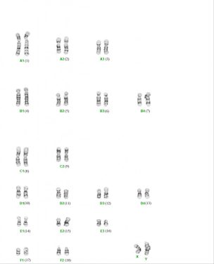 Cat Genomic Resources – Karyotypes – College of Veterinary Medicine